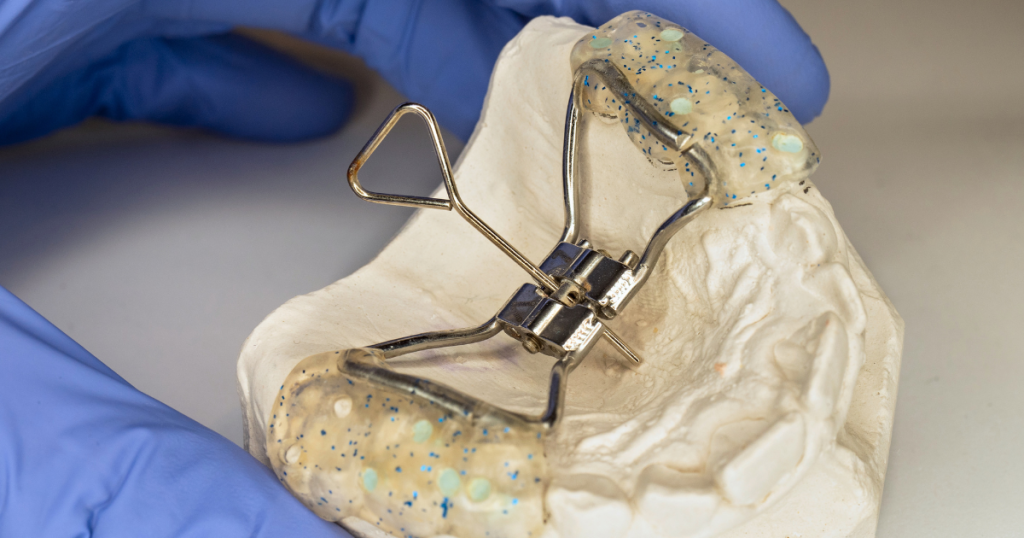 Types of Palatal Expanders & Their Benefits Explained